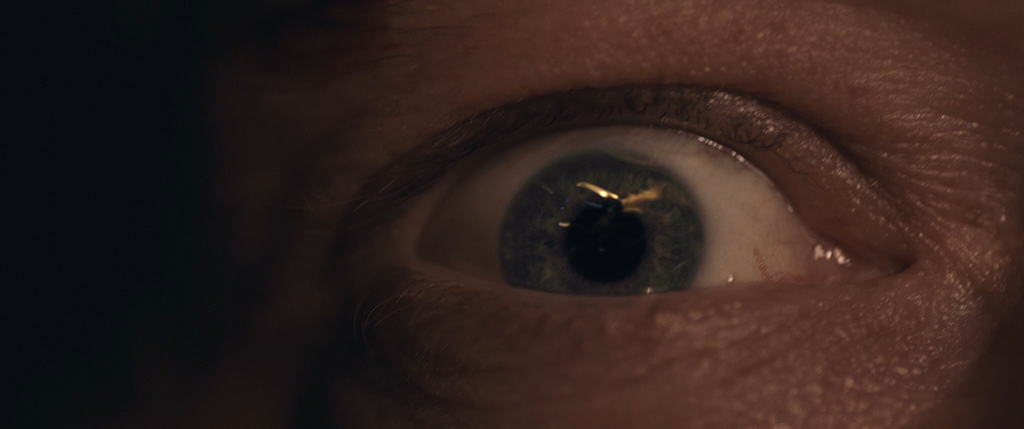 Surgery, the Final Cut Interview with Co-Director Sam Clemens ...